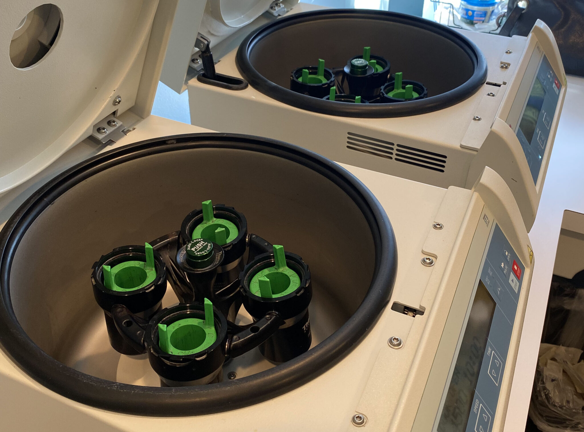 What is Cervicocranial Syndrome and How Can it be Treated?